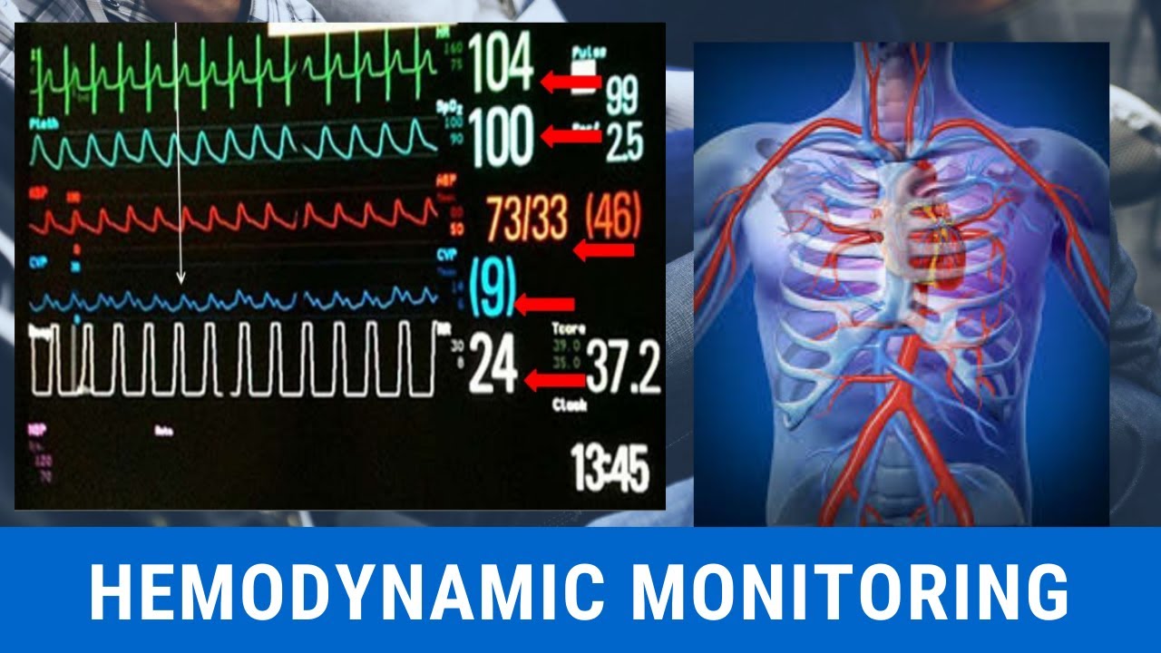 Hemodynamic Monitoring Youtube