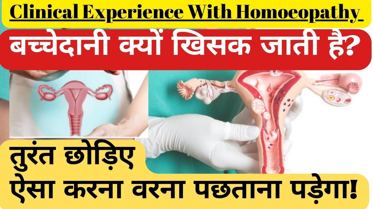 गर भ शय क ख सकन बच च द न क ब हर आन Prolapse Uterusproblem
