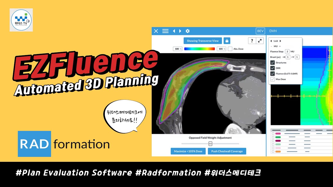Radformationㅣintroducing Ezfluence Automated 3d Planning Software