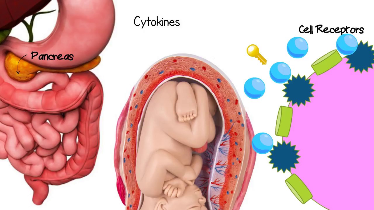 What Is Gestational Diabetes Animation Youtube