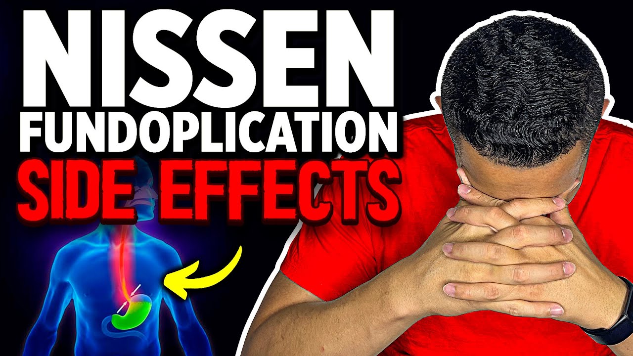 Lap Nissen Side Effects