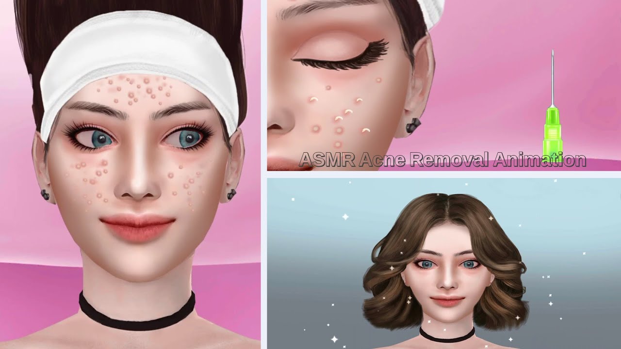 Asmr Acne Removal Treatment Animation Asmr Youtube