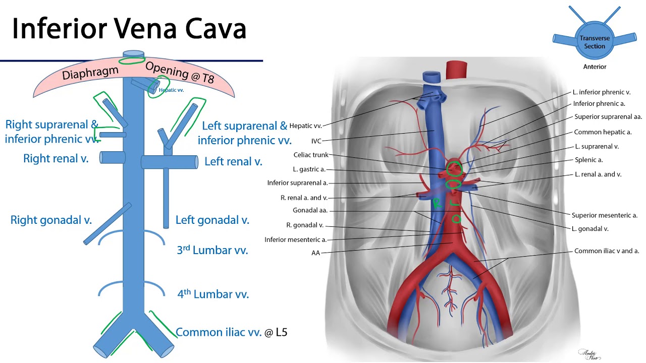 Abdominal Aorta Og Inferior Vena Cava Ppt Abdominal Aorta