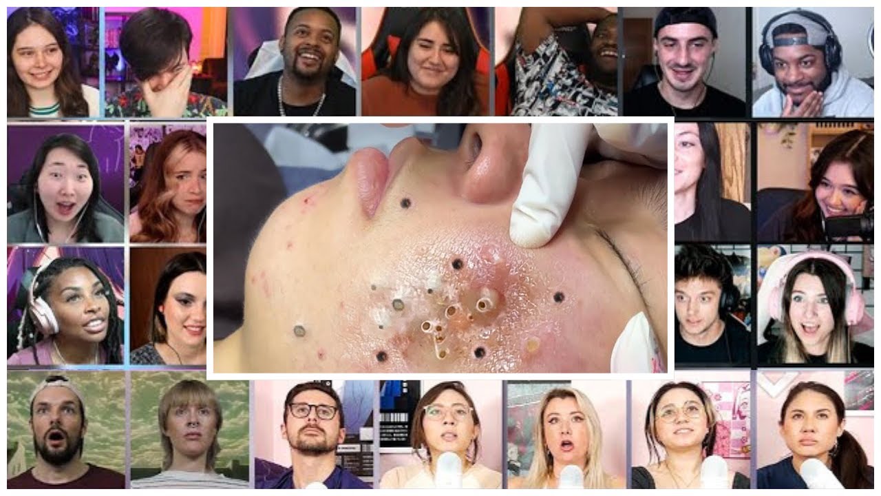 Pimple Tv The Best Pimple Popping 2023 Videos You Ll Find On The Internet