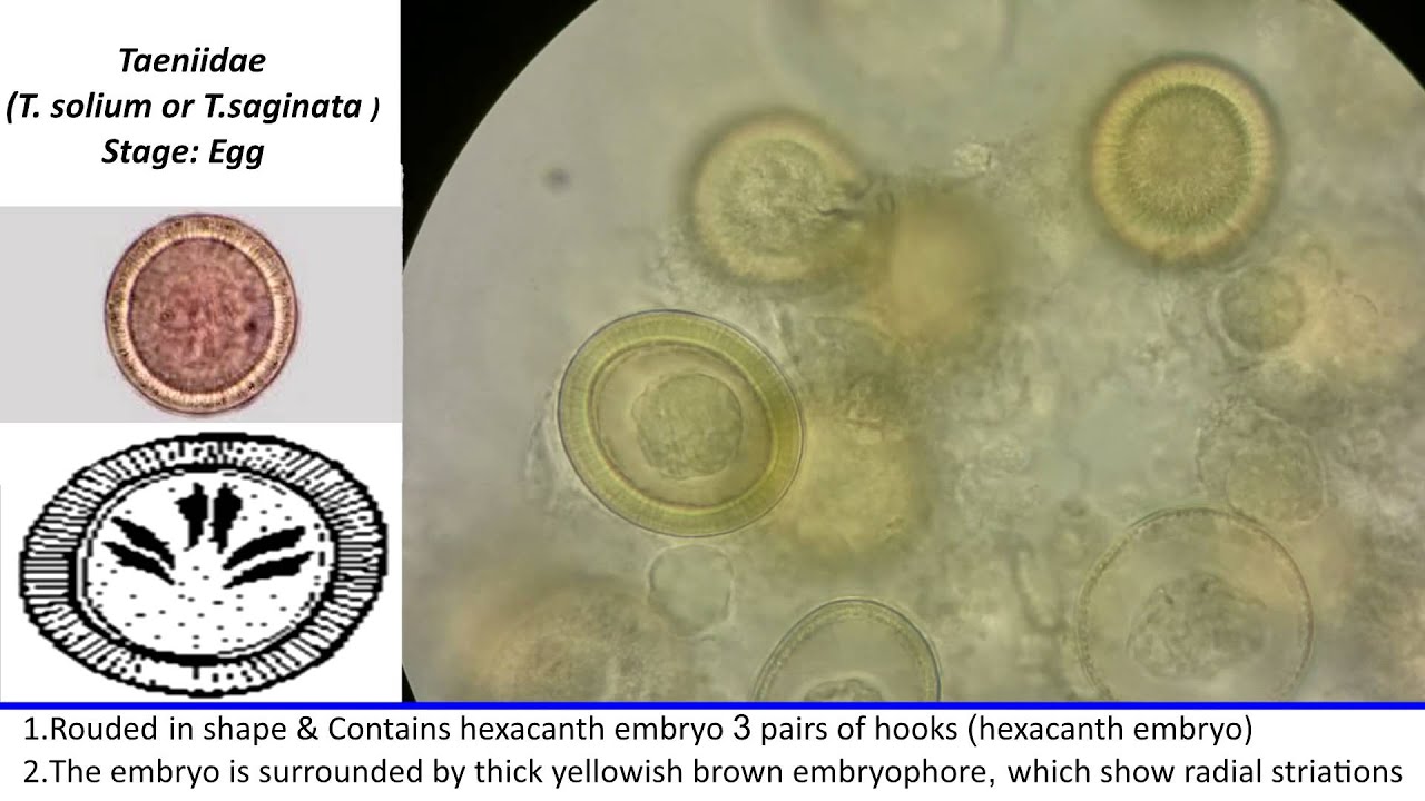 Taenia Saginata Egg Parasitology Lab At University Of New Orleans