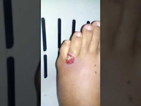 Picadura De Arlomo Youtube