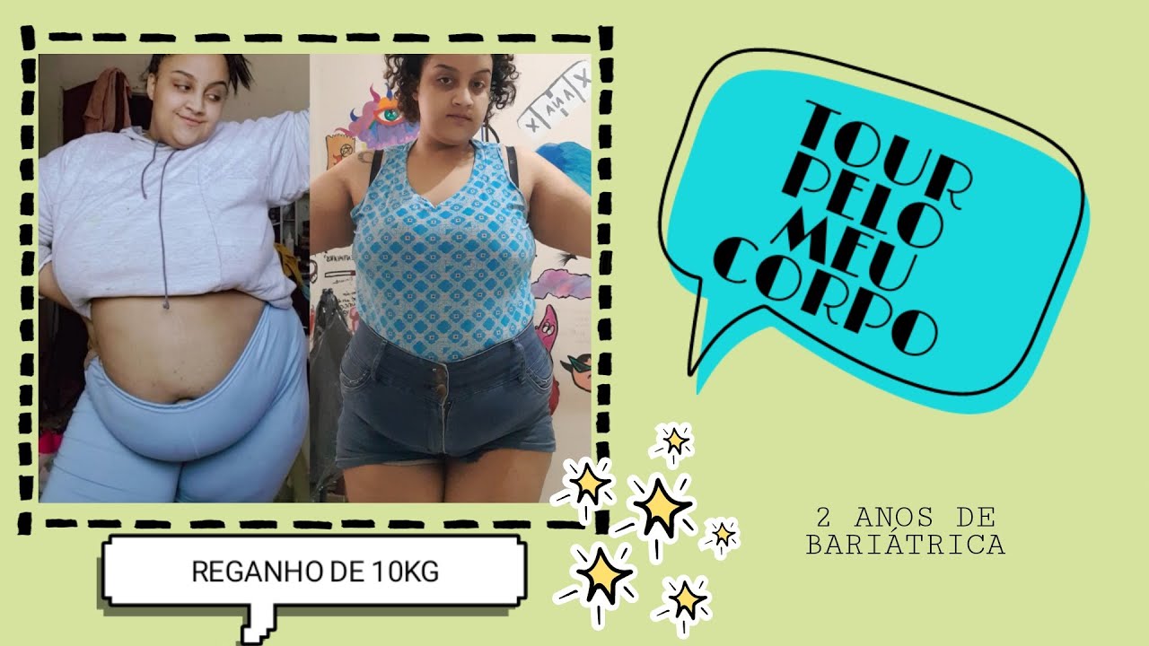 Tour Pelo Meu Corpo 2 Anos De Bariátrica Youtube