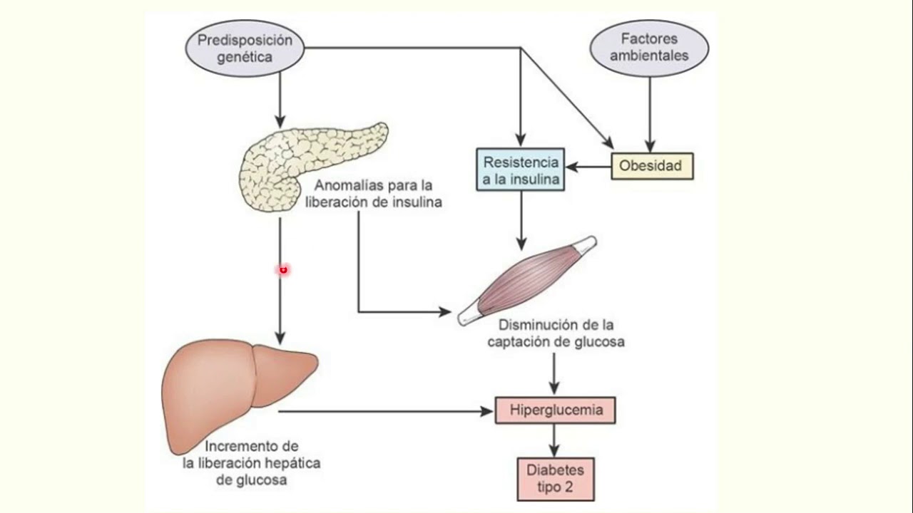 Diagrama De Fisiopatología De La Diabetes Tipo 2