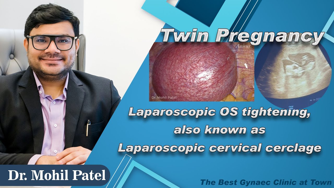 Laparoscopic Os Tightening Also Known As Laparoscopic Cervical
