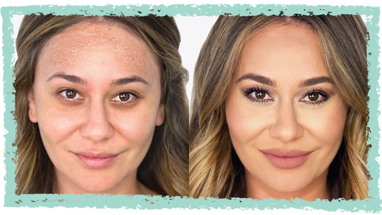 Melasma Cover Up Makeup Uk Mugeek Vidalondon