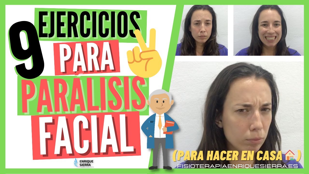 Parálisis Facial O Parálisis De Bell Ejercicios Para Eliminarla Por