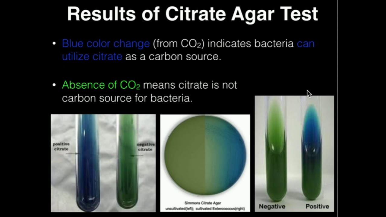 Citrate Test