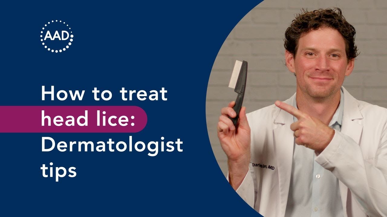 How To Treat Head Lice Dermatologist Tips Youtube