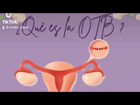 вїquг Es La Otb O La Oclusiгіn Tubгўrica Bilateral рџњ Youtube