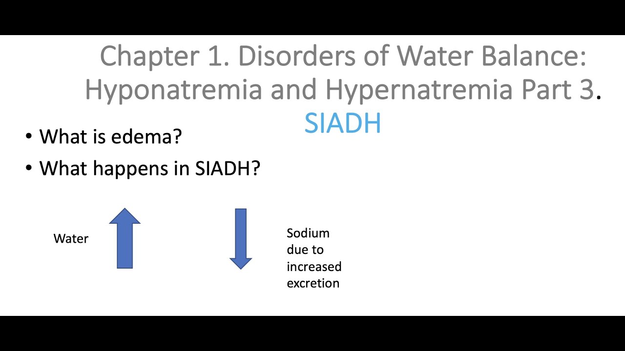 Hyponatremia Part 3 Siadh Youtube