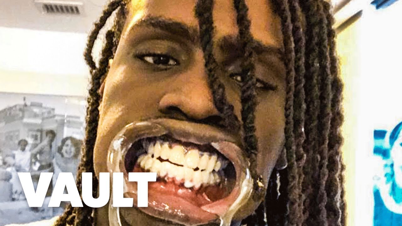 Chief Keef Funny Face