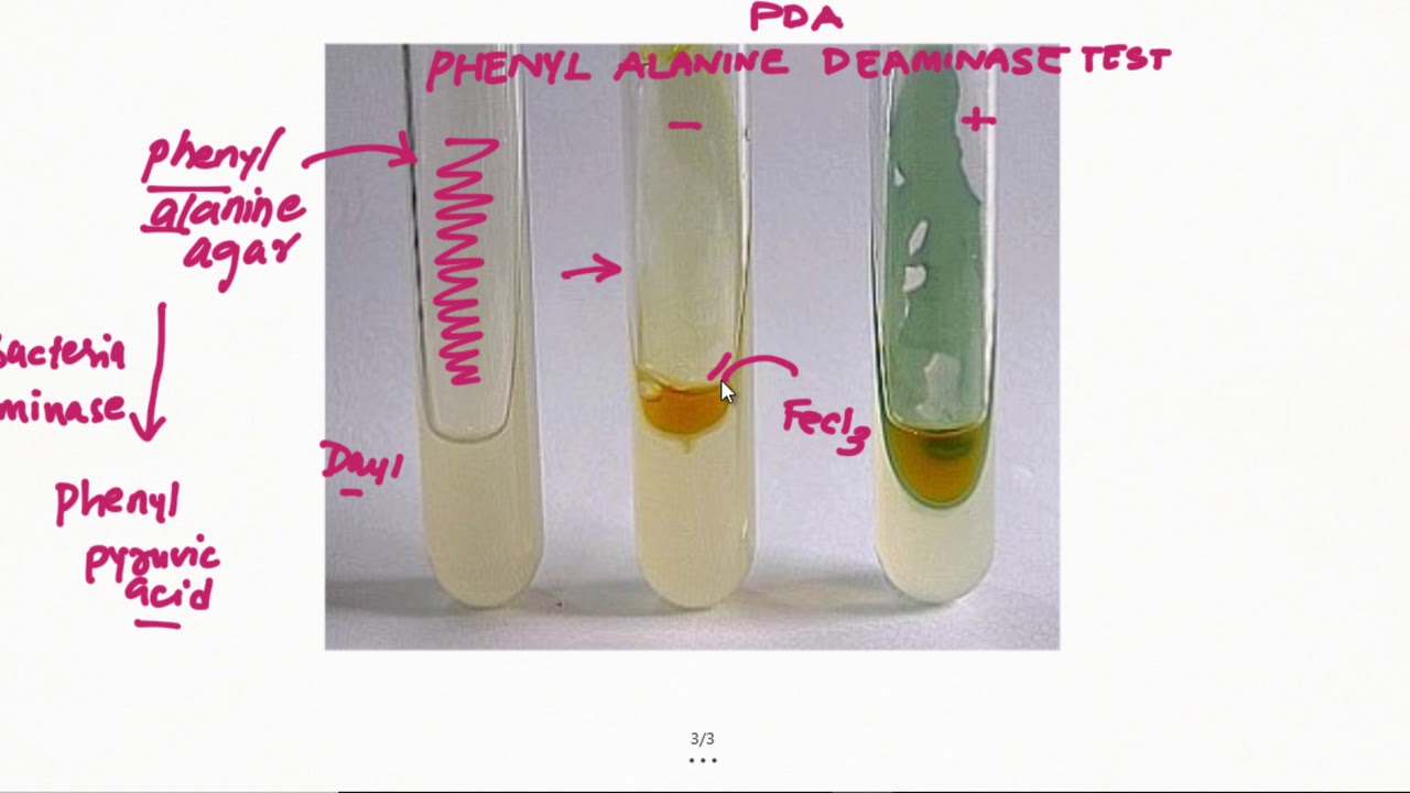 Phenylalanine Test Phenylketonuria What Is Pku Diagnosis And Pku