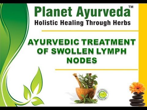 Swollen Lymph Nodes Glands Treatment With Herbal Remedies Youtube