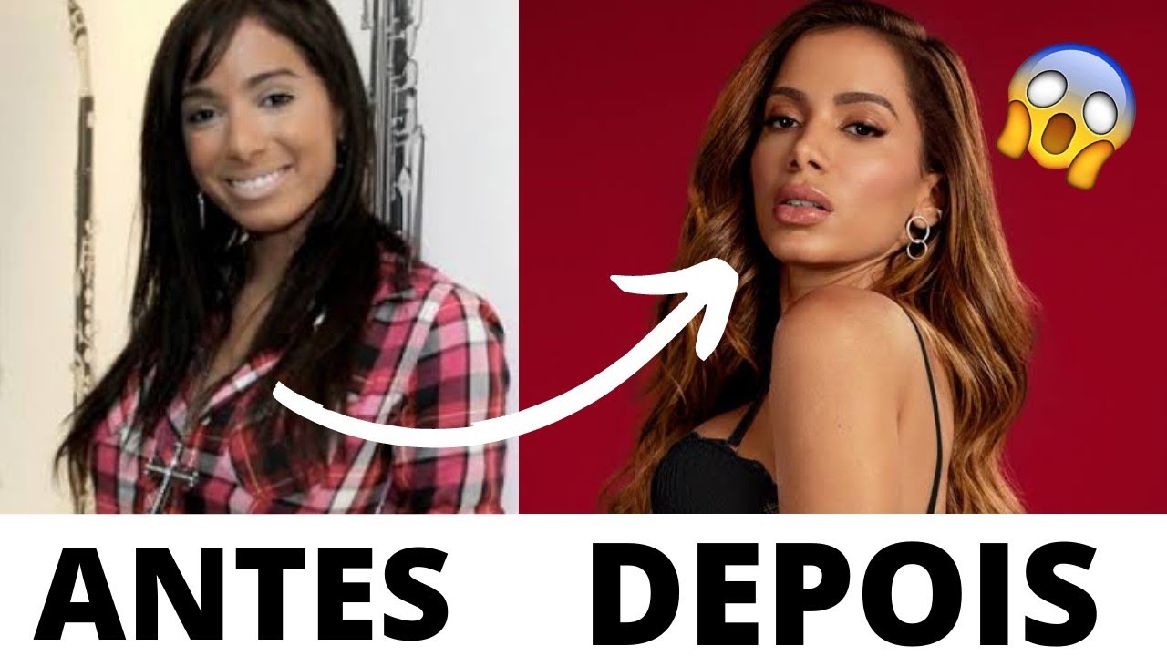 Anitta Antes Da Plastica