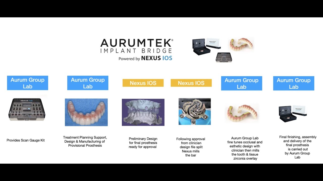 Aurumtek Implant Bridge Powered By Nexus Ios With Dr Michael Klein