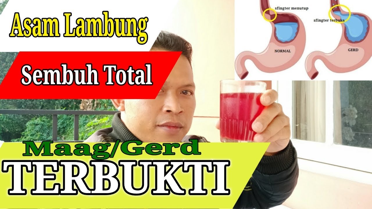 Cara Meredakan Sakit Lambung Herbal Premium Indonesia