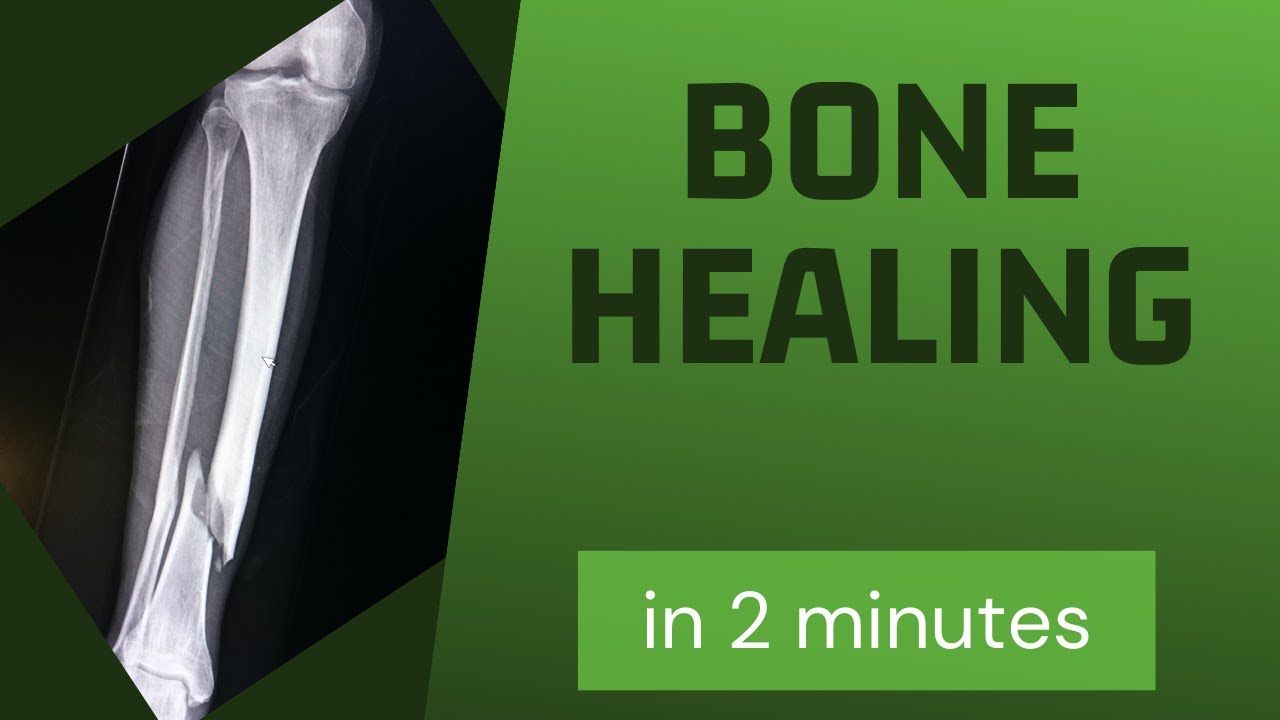 Bone Healing In 2 Mins Youtube