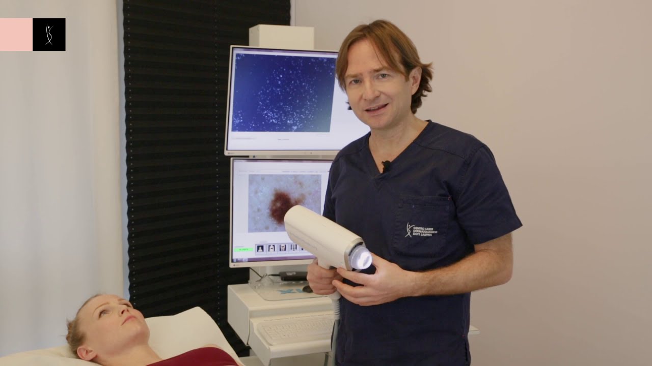 Videodermatoscopia Youtube