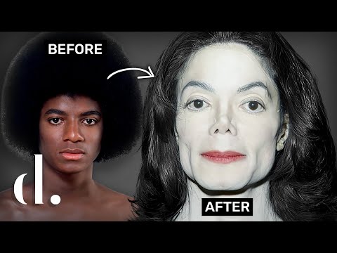 How Many Times Did Michael Jackson Have Plastic Surgery