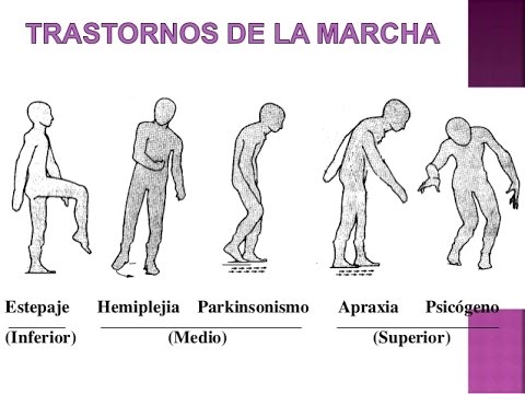 Diferentes Tipos De Marcha Anormales Que Hay Y Como Corregir Youtube