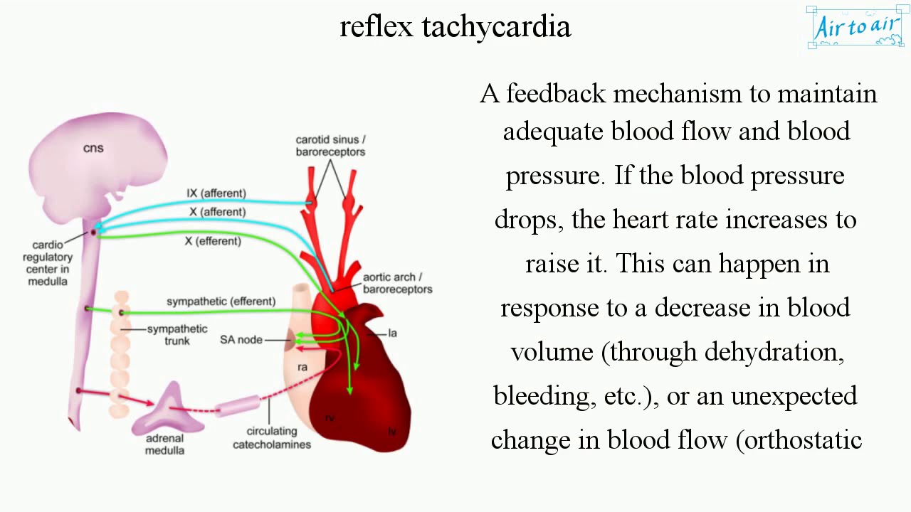 Reflex Tachycardia Youtube