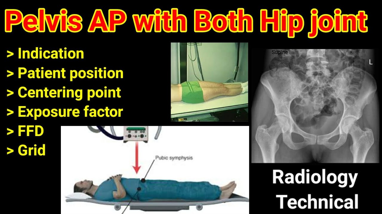 Hip X Ray Technique At Emily Marsh Blog