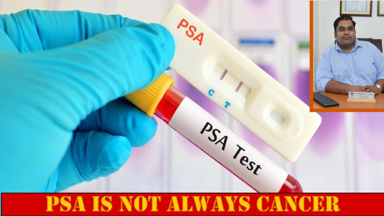 What Is Psa Mean Cards At Nancy Jensen Blog