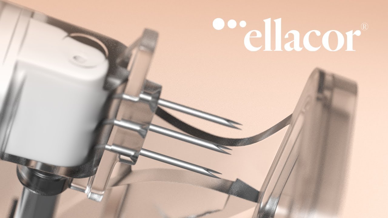 Ellacorﾂｮ System With Micro Coring邃 Technology Method Of Action Youtube