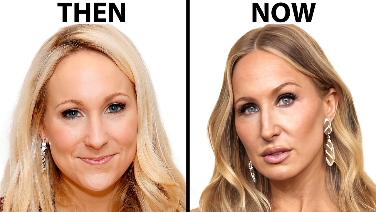 Nikki Glaser S New Face Plastic Surgery Analysis Cyber Clinic