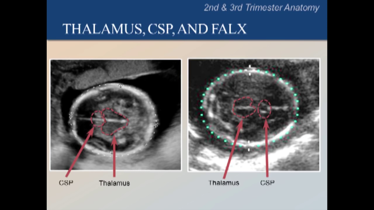 What Is Csp In Medical Terms At Lucille Swiney Blog