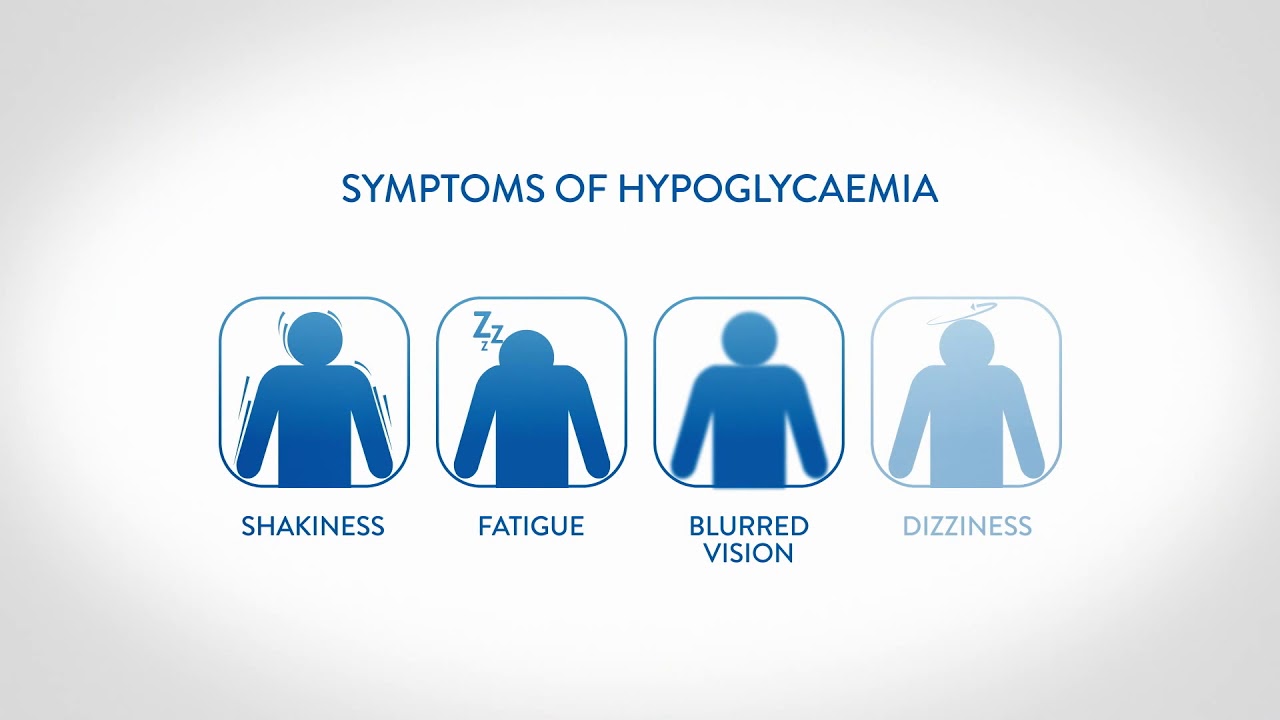 Smartguard Explained Youtube