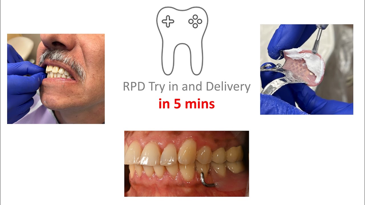 Rpd Wax Try Delivery In 5 Mins Youtube