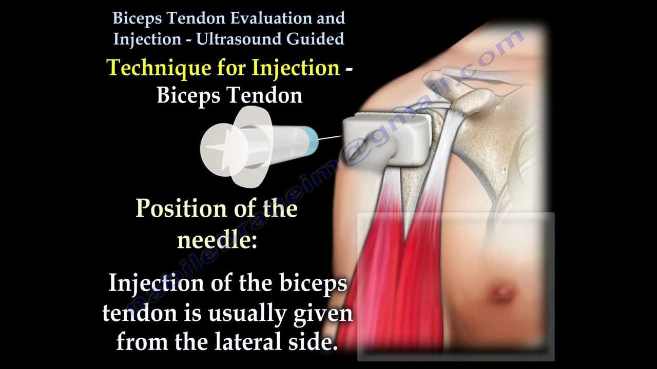 Biceps Tendon Evaluation Injection Ultrasound Everything You Need To