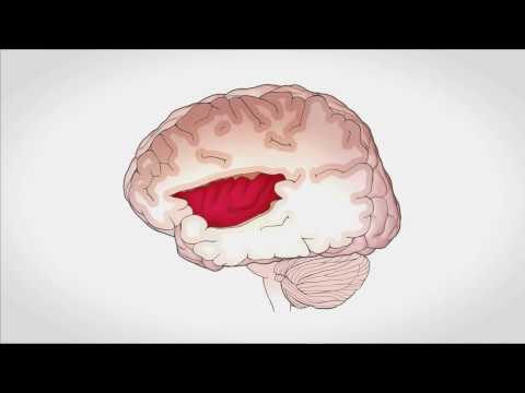 La Relación Del Cerebro Y El Corazón Luciano Sposato Youtube