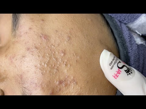 Relax Every Day With Sac Dep Spa 816 Youtube