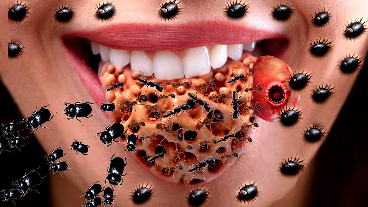 Asmr Animation Treatment From Infected Tongue Asmr Treatment