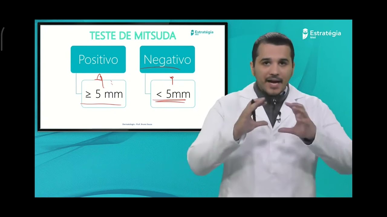 Cai Na Prova Do Revalida Inep 2023 2 Hanseníase Estrategiamed Youtube