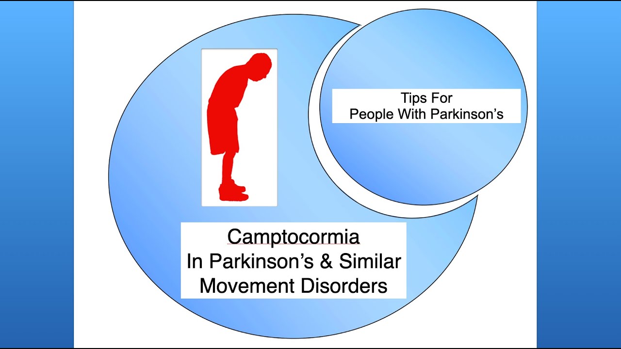 Camptocormia In Parkinsonism Youtube