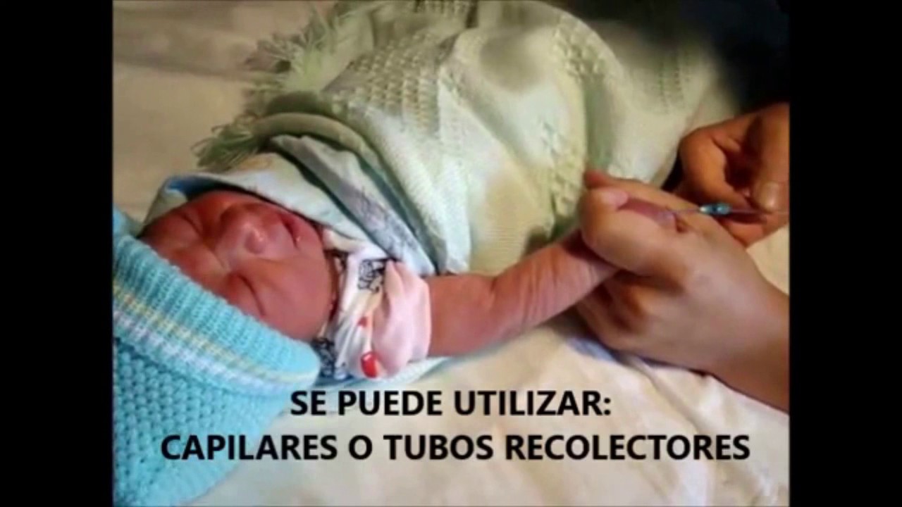 Toma De Muestra En Neonatologia Www Sopelab Com Youtube