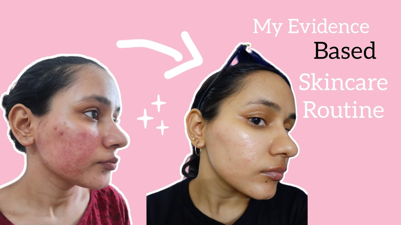 Minimal Skincare Routine Which Changed My Skin Evidence Based