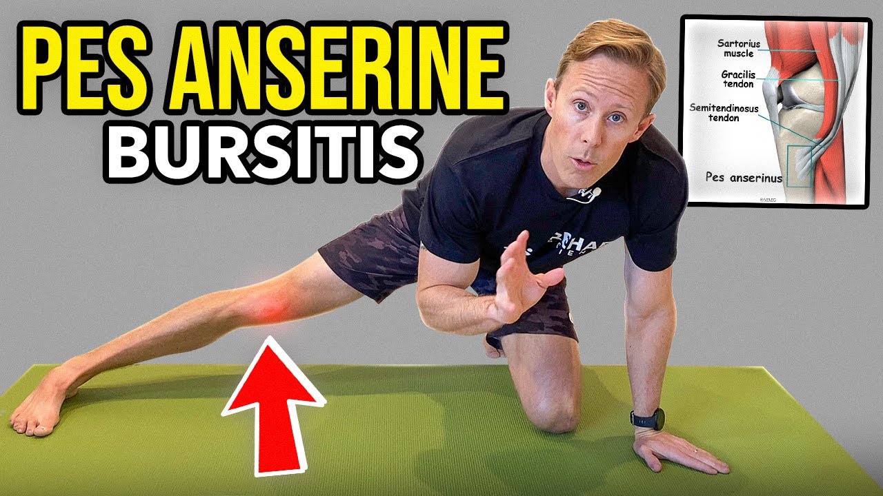 Therapy Exercises For Knee Bursitis At George Ricketson Blog