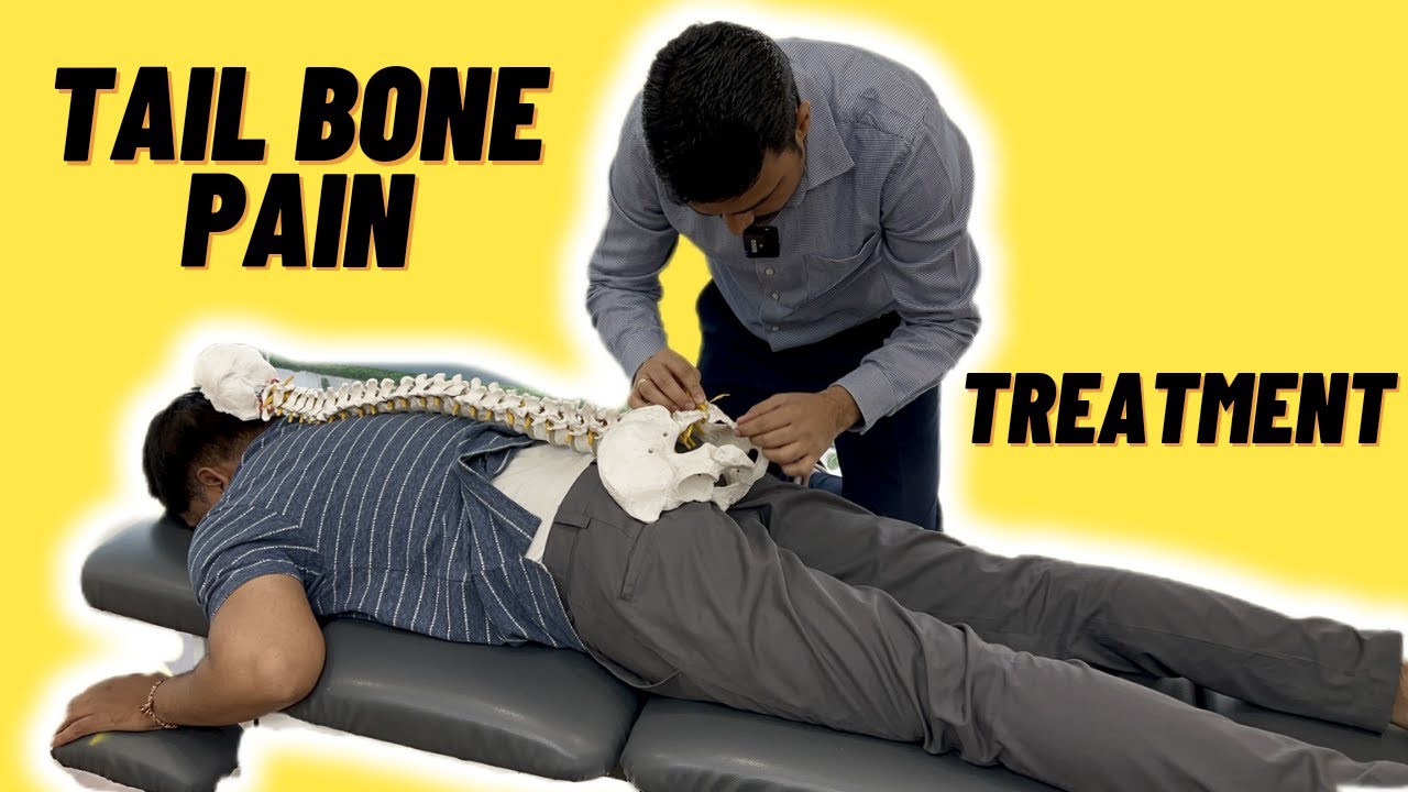 Tail Bone क दर द क सबस अच छ इल ज Dr Harish Grover Chiropractic