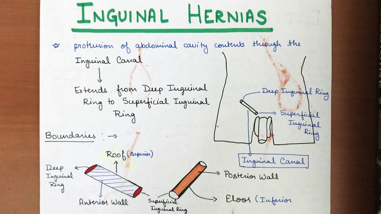 Types Of Anesthesia For Inguinal Hernia Surgery At Sandra Santos Blog
