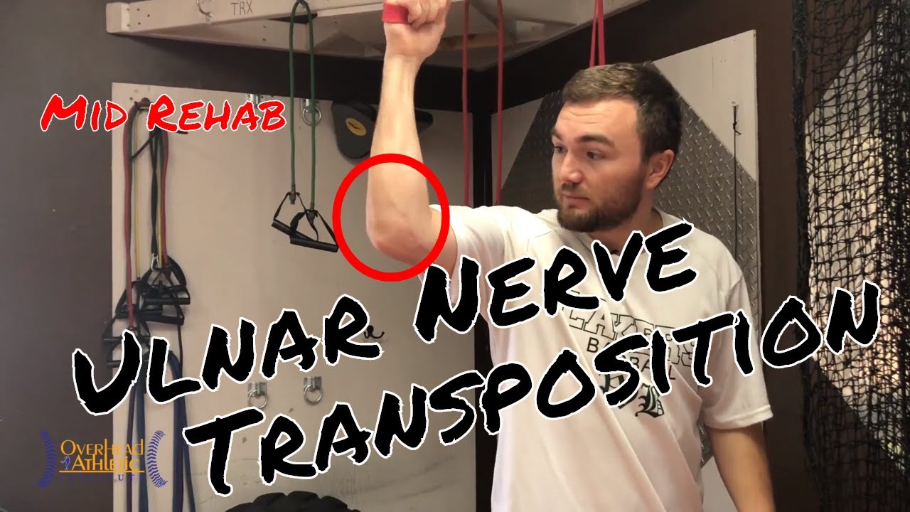 Ulnar Nerve Entrapment