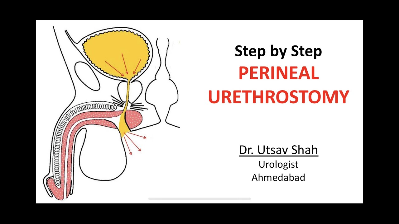 Step By Step Perineal Urethrostomy Bodylinehospitals Youtube